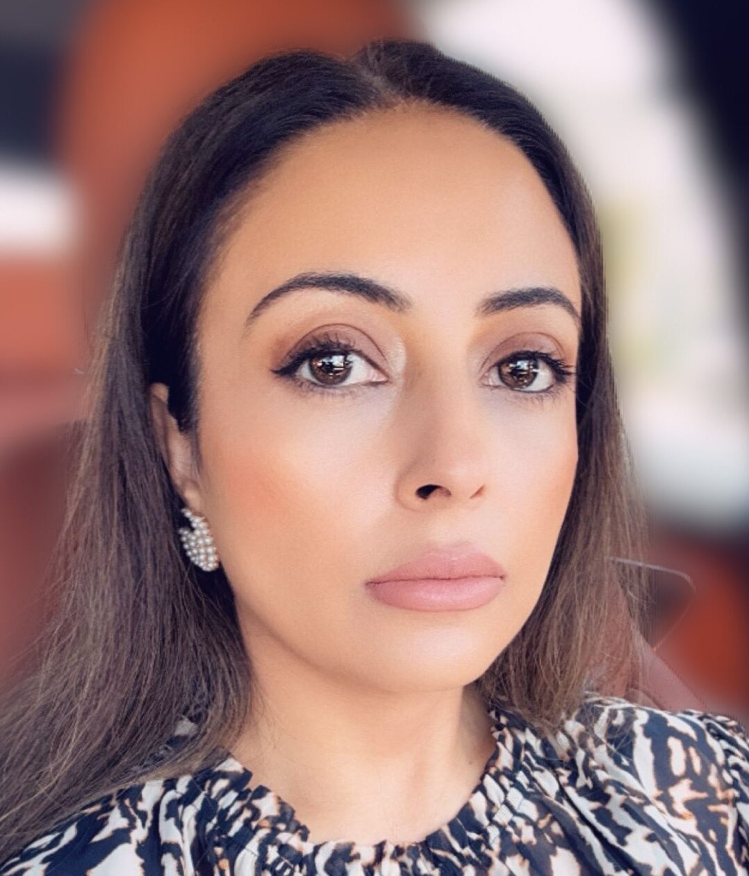 Khatera Ali, AES - Southern California Dermatology